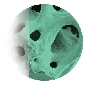 Dental Bone Graft Material Options: A-Graft | Hiossen® Implant